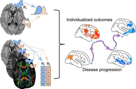 Structural Covariance Analysis For Neurodegenerative And Neuroinflammatory Univ Prof Dr Med