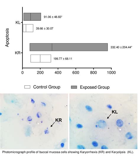 Apoptotic Dna Fragmentation In Buccal Mucosa Cells From Workers Exposed Download Scientific
