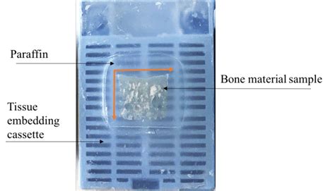 FFPE Bone Block Of Sample Orange Arrows Indicate Surface Area Of