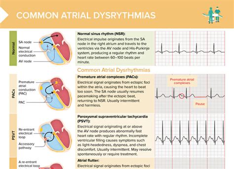 Basic Arrhythmia Cheat Sheet Kendra Ward And Bob Bence Lets