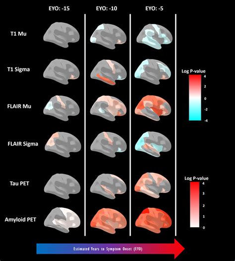 Human Brain Mapping Neuroimaging Journal Wiley Online Library