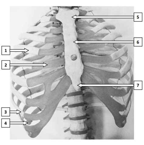 Axial Skeleton Bone Quiz Vertebrae Flashcards Quizlet
