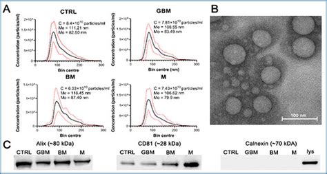 Raman Spectral Signatures Of Serum Derived Evs May Serve As Liquid Biopsy For Diagnosis Of Cns