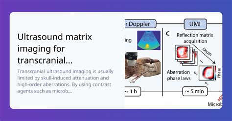 Ultrasound Matrix Imaging For Transcranial In Vivo Localization Microscopy Ai Research Paper