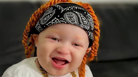 Black Mother Gives Birth To An Albino Baby With Ginger Hair In Black Mother Ginger Hair