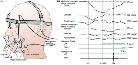 A The Device Custom Built To Monitor Movement Of The Lower Jaw Download Scientific Diagram