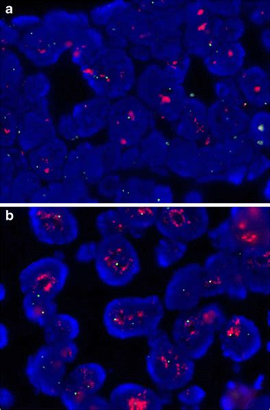 Photomicrographs Of Dual Probe Fish Analysis ×1000 Original