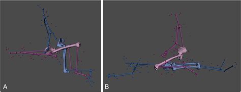 Sexual Activity After Total Hip Arthroplasty A Motion Capture Study The Journal Of Arthroplasty