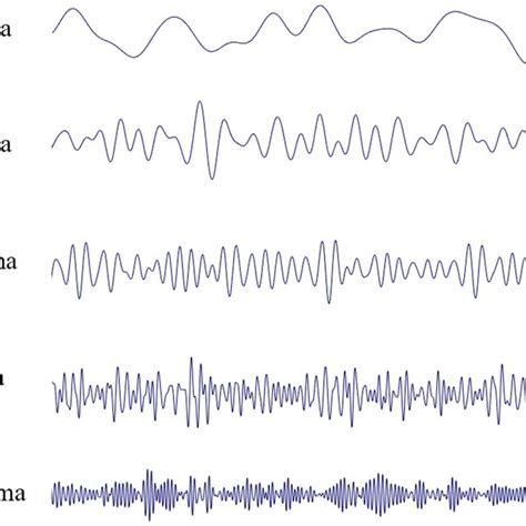 Eeg Recordings Performed In Patients The Waveform Can Be Download Scientific Diagram