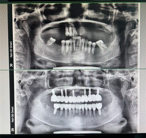 Adore Энэ жилийн төгсгөлд хамгийн хэцүү кейсийнхээ ард бид амжилттай гарч чадлаа Дээд түүшинд