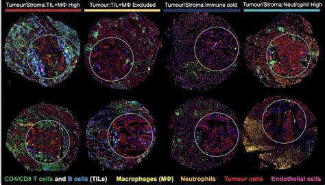 Jorge Zambrano Phd On Linkedin Mapping Tumor Microenvironments