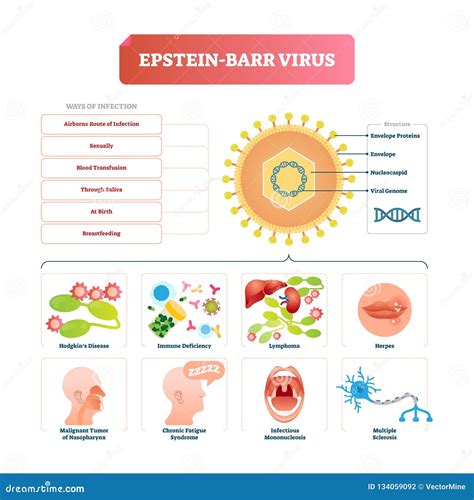 Diagram Of Herpes Simplex Virus Particle Structure Vector Illustration