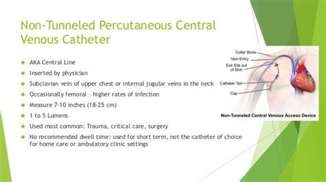 Superb Tips For Tunneled Central Venous Catheter Cpt Codes Medical