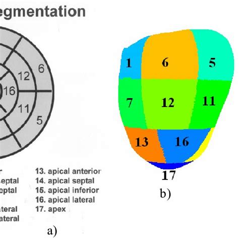 A The Aha 17 Segment Model For Myocardial Segmentation Figure