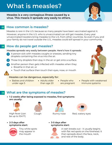 What Is Measles Ocoh