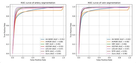 receiver operating characteristic roc curves of retina based