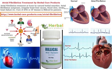 Atrial Fibrillation Treatment Symptoms Causes Herbal Care Products