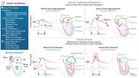 Physiology Heart Murmurs Stenosis And Regurgitation Ditki Medical And Biological Sciences