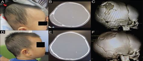 Journal Of Craniofacial Surgery