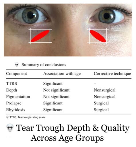 Yousef Nazari On Linkedin 💀 Tear Trough Depth And Quality Across Age Groups 🔻 The Tear Trough…