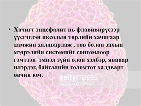 хачигт энцефалит Pptx