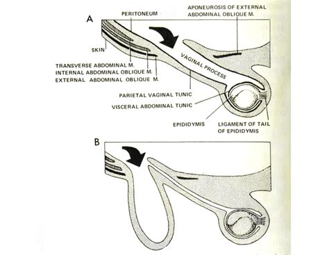 Canine Inguinal Hernia