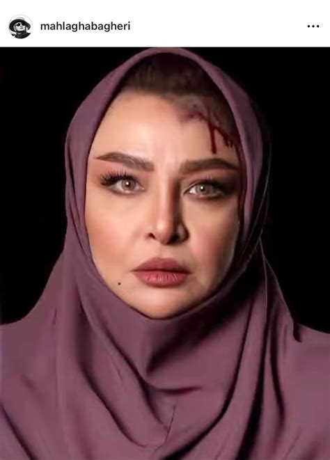 تغییر چهره شوکه کننده مه لقا باقری بعد از عمل زیبایی کره ای خانم با