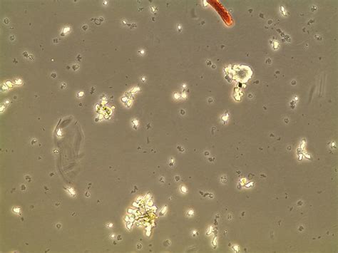 How Do You Culture Antigen Specific T Cells Researchgate