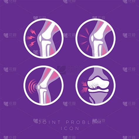图标集。关节和他们的治疗。软骨损伤，关节炎，骨关节炎，软骨修复，疼痛缓解。
