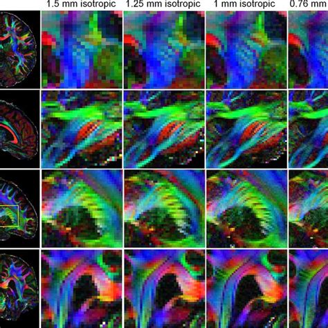 Comparison Of Dmri Results At Different Spatial Resolutions Colored Fa Download Scientific