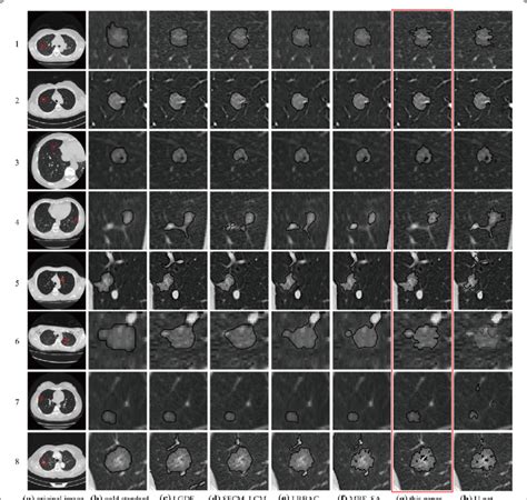 Segmented Results Of Clinical Data Download Scientific Diagram
