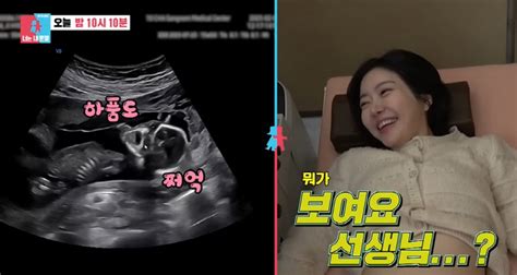Can You See That Lady Jane ♥ Lim Hyun Tae Reveals The Sex Of Twins Sportschosun