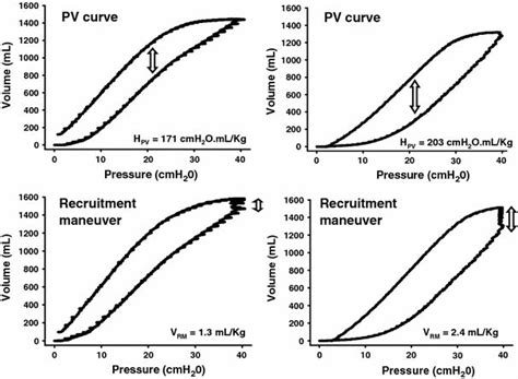 Pvloop Tool Lung Icu Intensivecare Ards Andrea Glotta