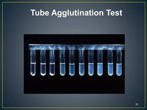 Agglutination Test Antigen Antibody Reaction Pptx