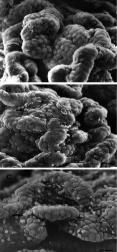 SEM Image Of The Fourth Ventricle Choroid Plexus A Normal Structure Download Scientific