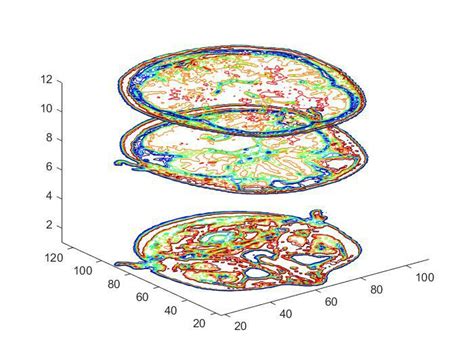 Create A Stacked Contour Plot Of The Mri Data Showing The 1st 8th And 12th Layer Of The Data