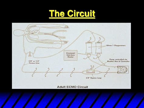 Ppt Ecmo Powerpoint Presentation Free Download Id 196175