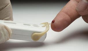 Malaria Schnelltest AtomoRapid Atomo Diagnostics Plasmodium Blut