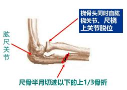 文章详情