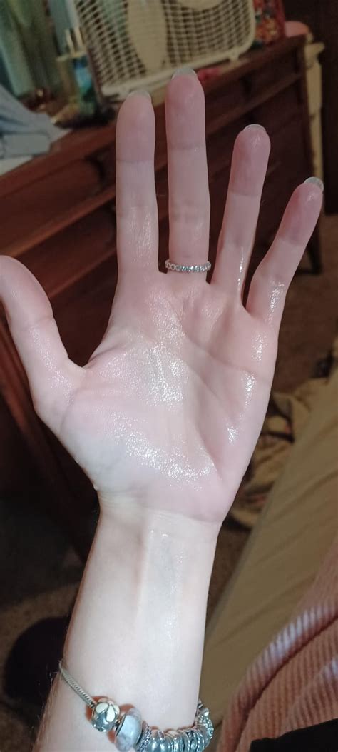My Friend Is Coming Over And I Went For A Walk 2 Hours Ago 🥲 R Hyperhidrosis