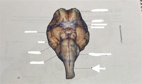 Sheep Brain Inferior View Labeling Diagram Quizlet