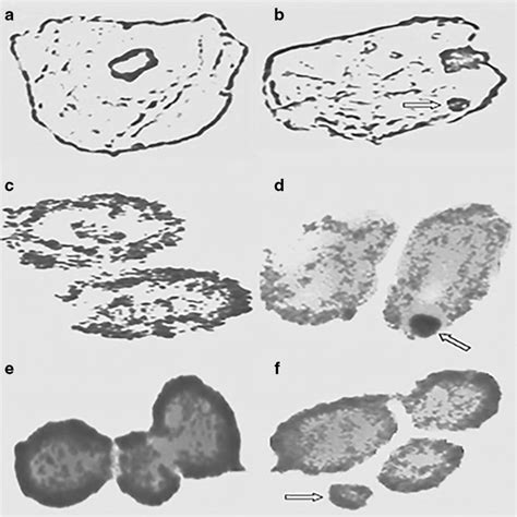 H O Induced MN Formation A Normal Appearance Of Buccal Mucosa