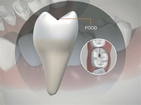 Preventative Nish Dental Clinic