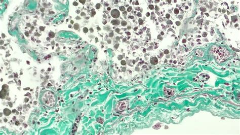 How Light Microscopes Work HowStuffWorks