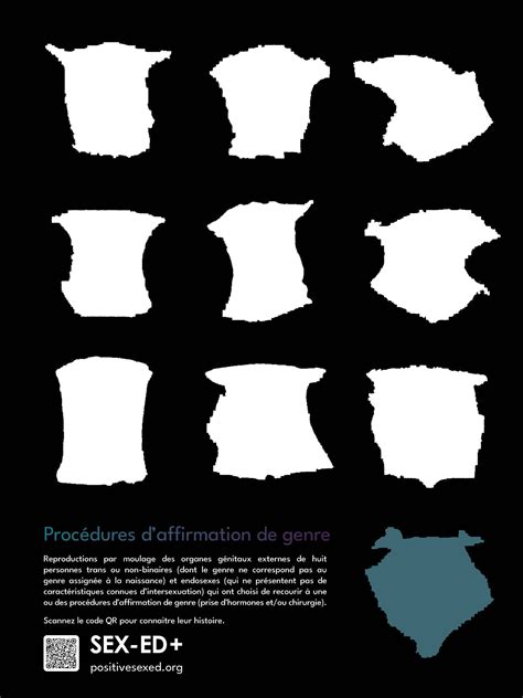 Poster Procédures Daffirmation De Genre Sex Ed Poster Procédures Daffirmation De Genre Sex Ed