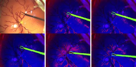 Figure 3 From Articulated Object Tracking By Rendering Consistent Appearance Parts Semantic