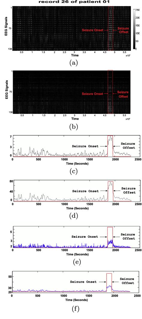 Figure 2 From Long Term Epileptic Eeg Classification Via 2d Mapping And Textural Features