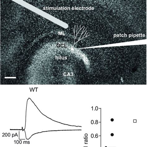 Comparable Excitatory And Inhibitory Synaptic Transmission In Dentate