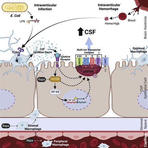 The Choroid Plexus Links Innate Immunity To Csf Dysregulation In