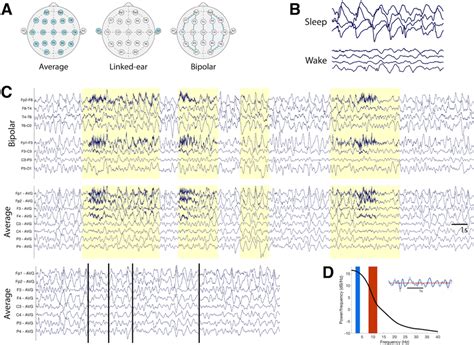 eeg data processing procedure a data were referenced to three